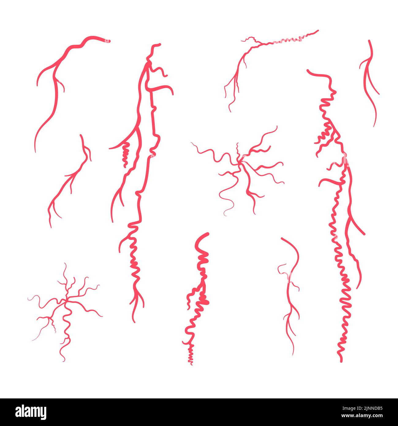 Varicose veins illustration Banque de photographies et d’images à haute ...