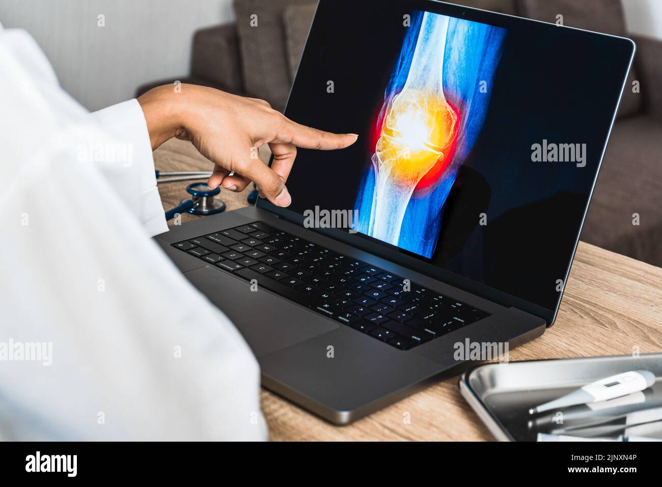 Knee joint xray Banque de photographies et d’images à haute résolution ...