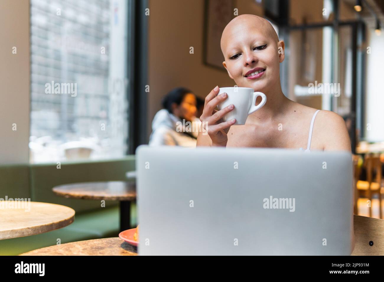 maladie, perte de cheveux, alopécie universalis, positivité corporelle ...