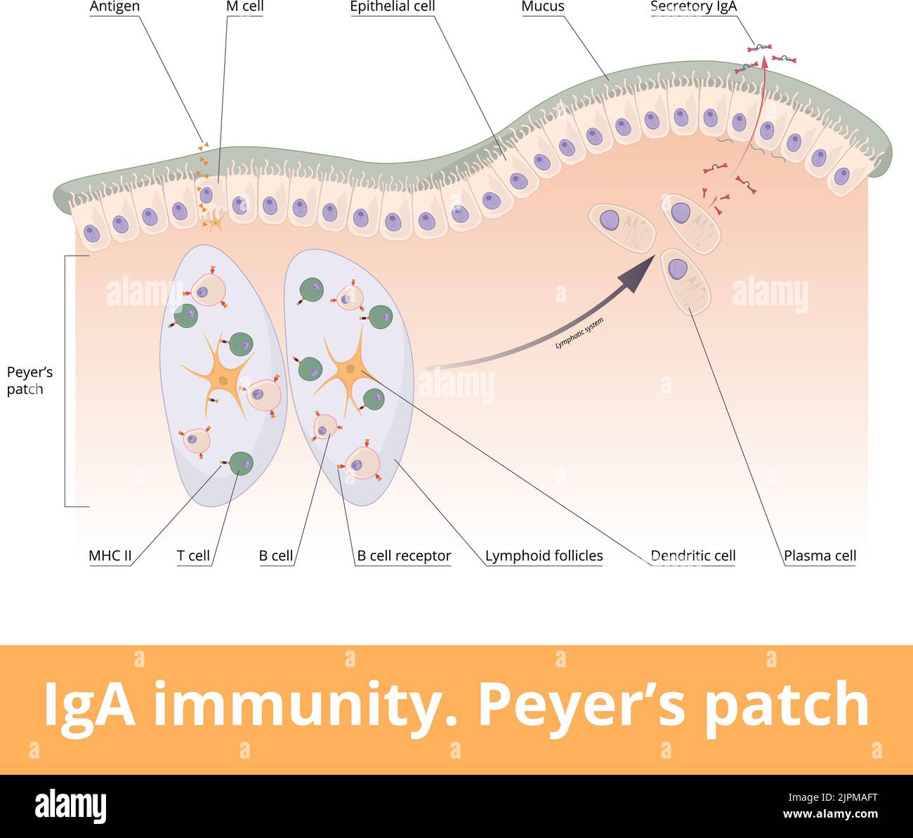 Immunité IGA. Le patch de Peyer. Les follicules lymphoïdes de l ...