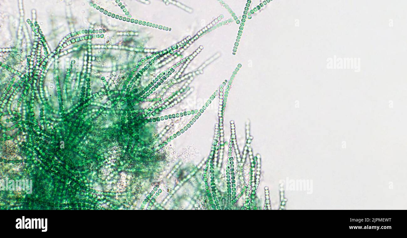 Algues bleues sous une vue microscopique, cyanobactéries, bactéries ...