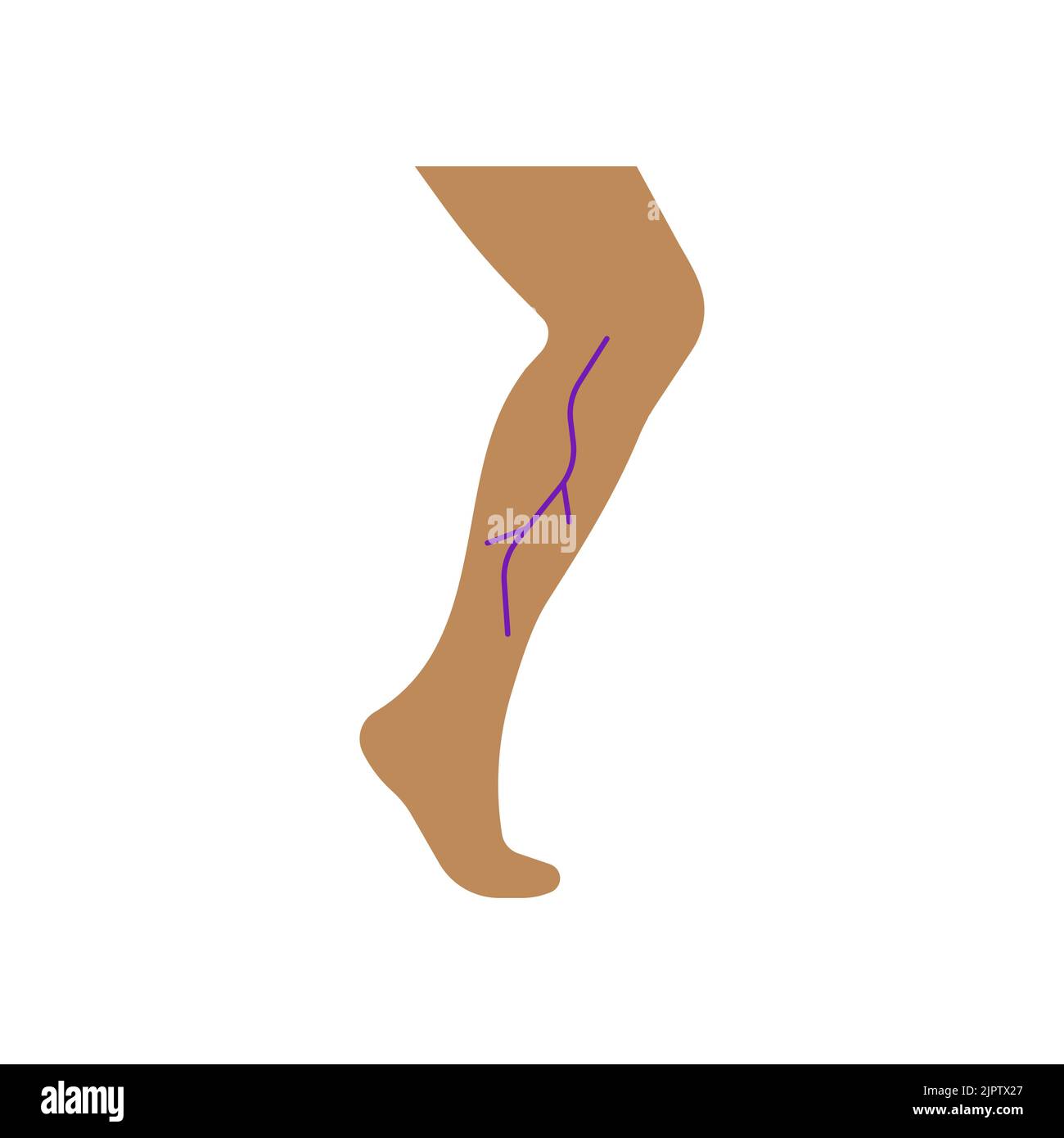 Varices jambes Banque d'images vectorielles - Alamy