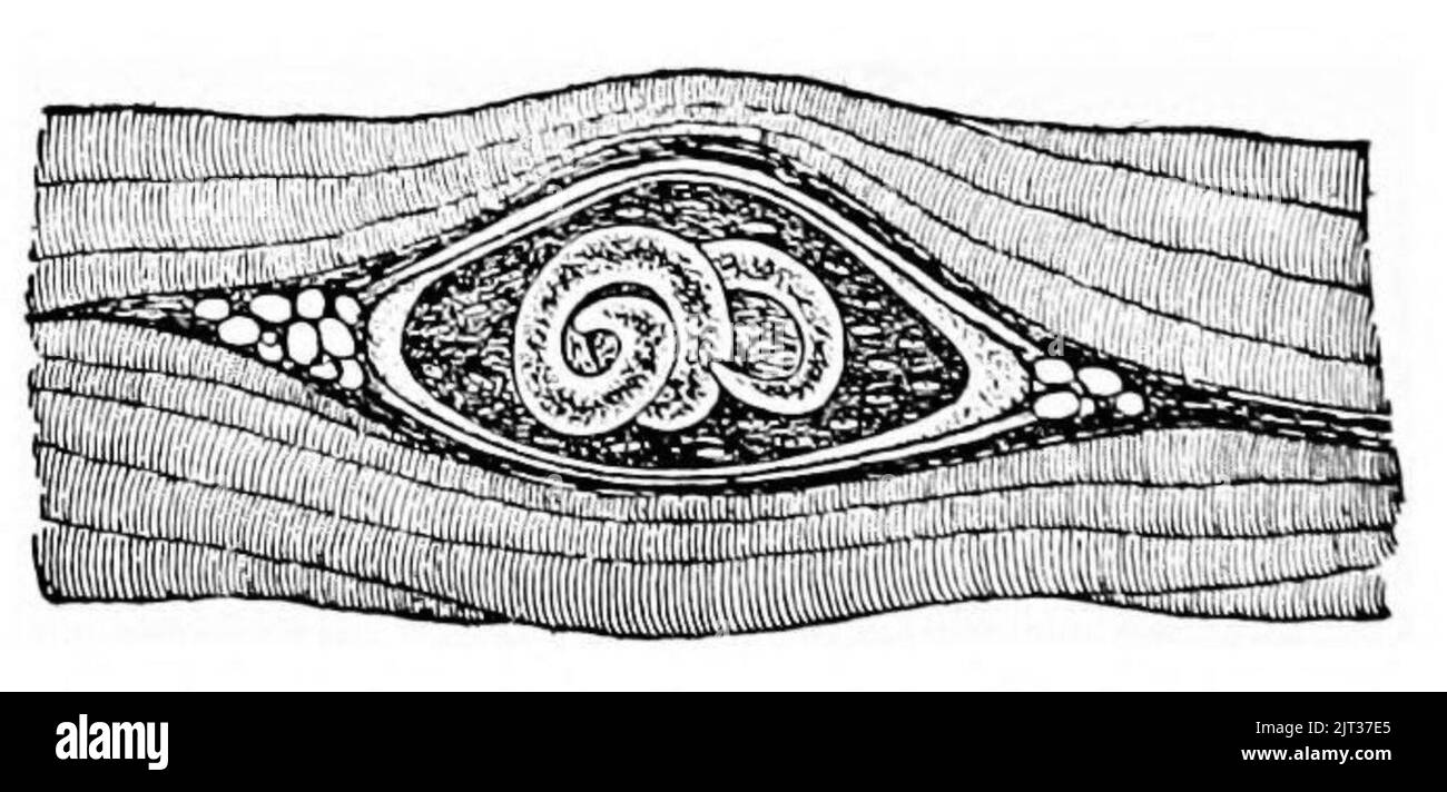 Trichinella spiralis Banque de photographies et d’images à haute ...