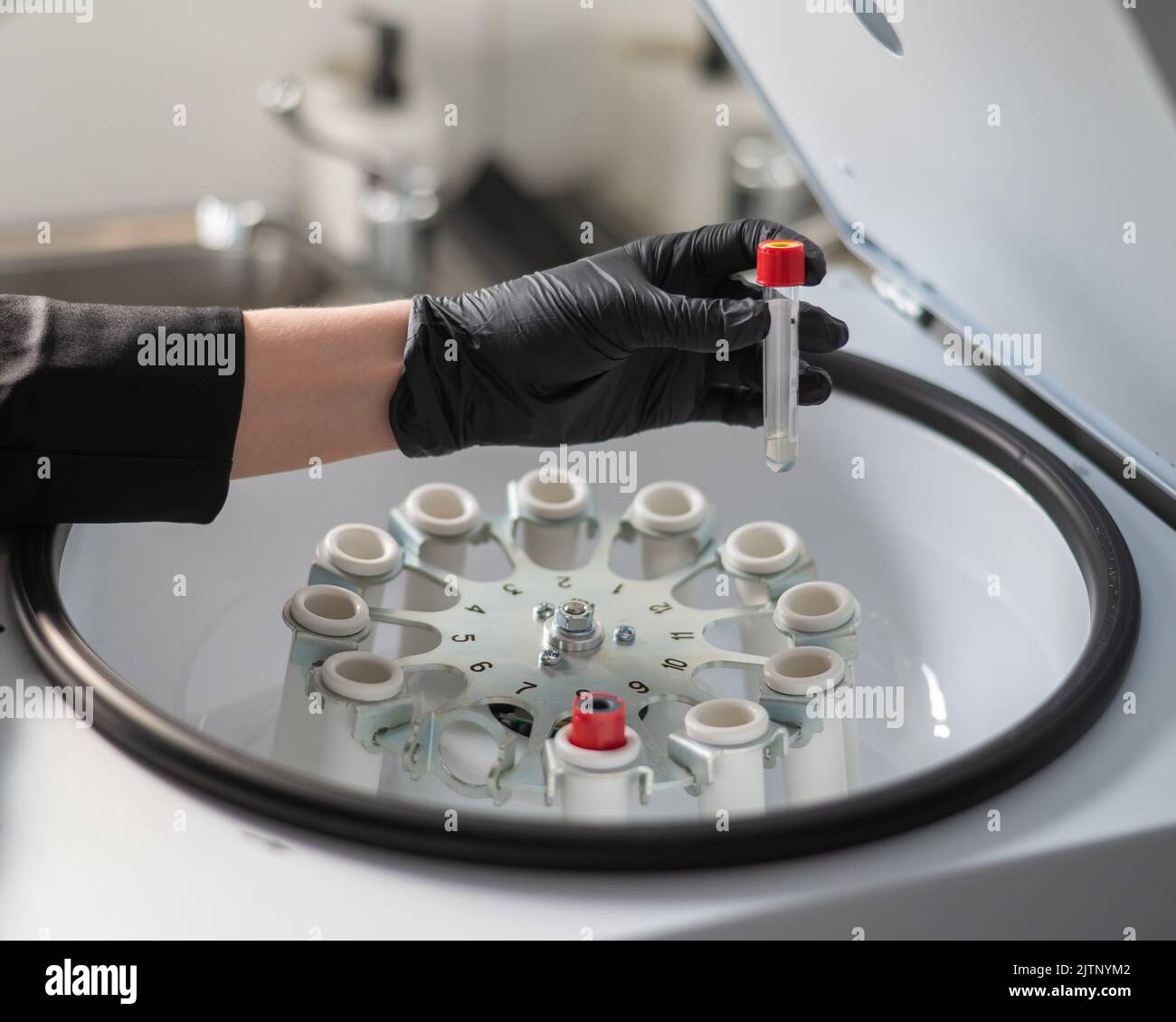Le médecin sort un tube à essai avec du plasma sanguin de la centrifugeuse. Procédure de ...