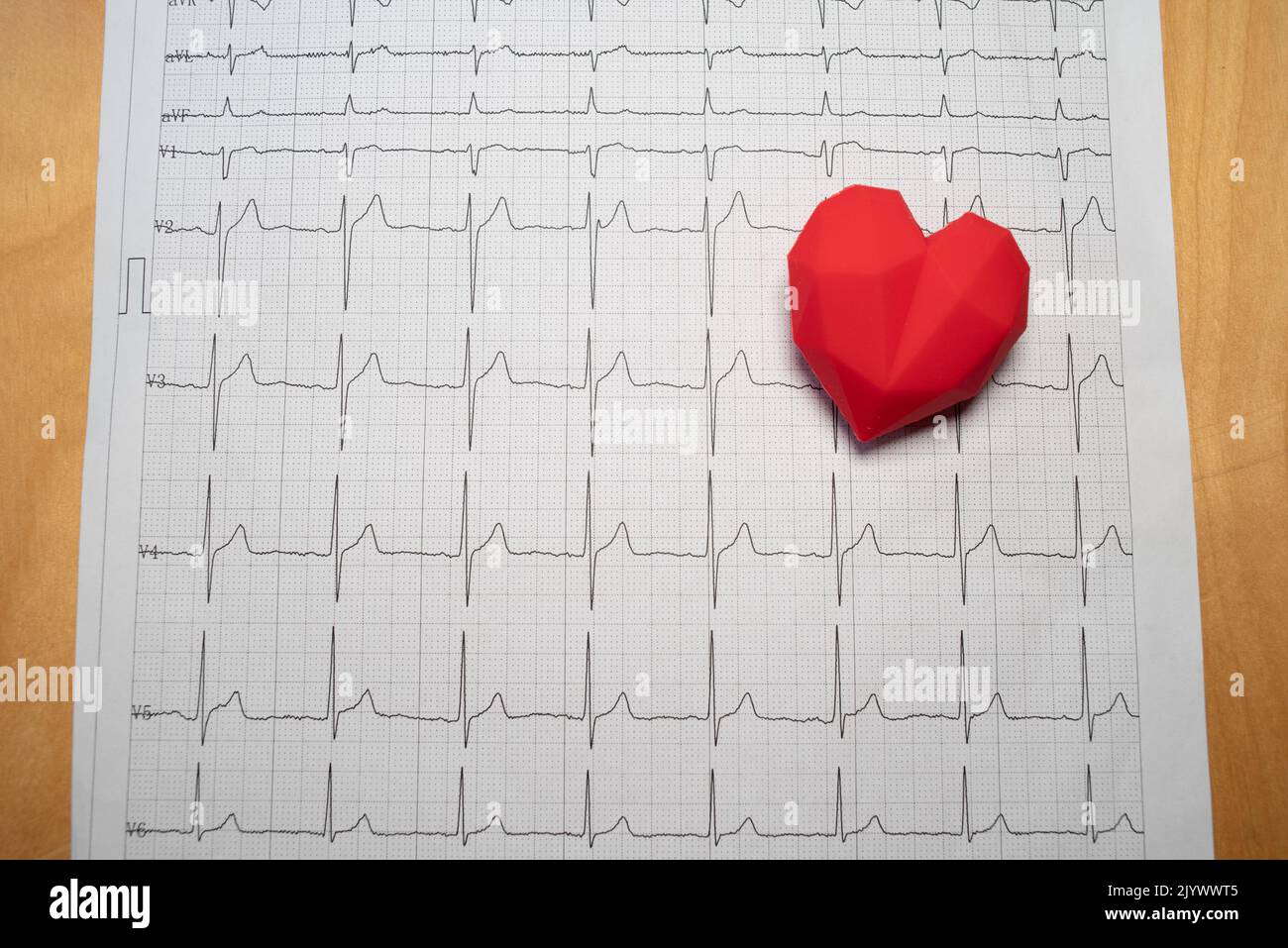 Gros plan du graphique du cœur et de l'ECG (électrocardiographe ...