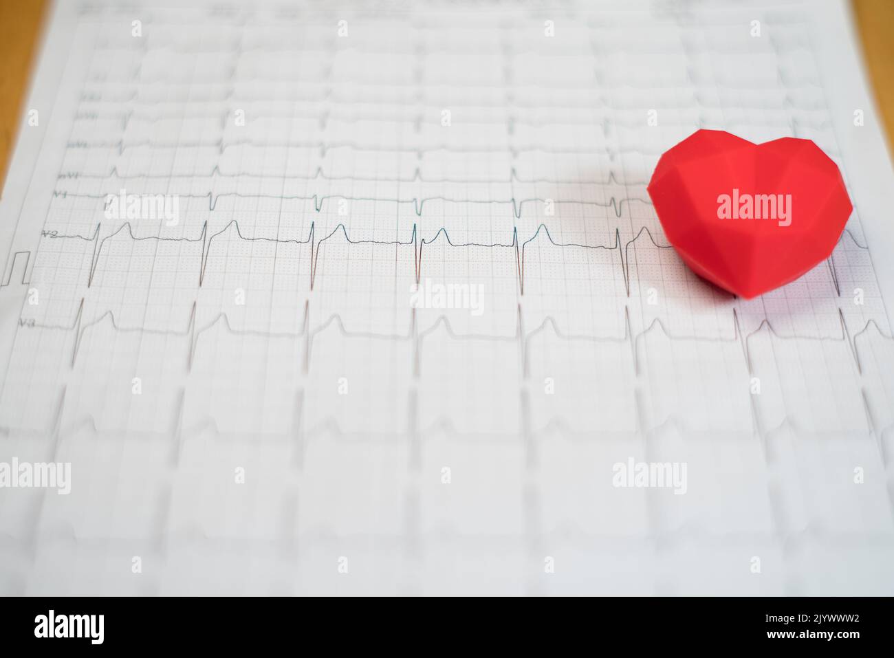 Gros plan du graphique du cœur et de l'ECG (électrocardiographe ...