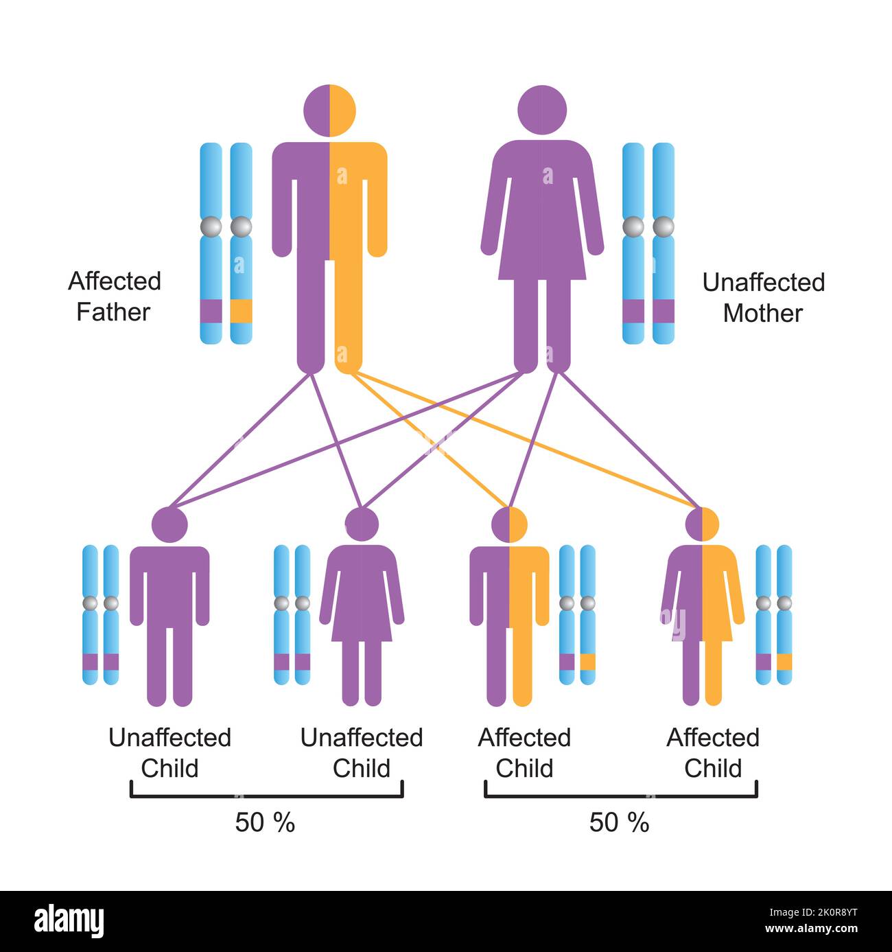 Autosomique dominante Banque de photographies et d’images à haute ...