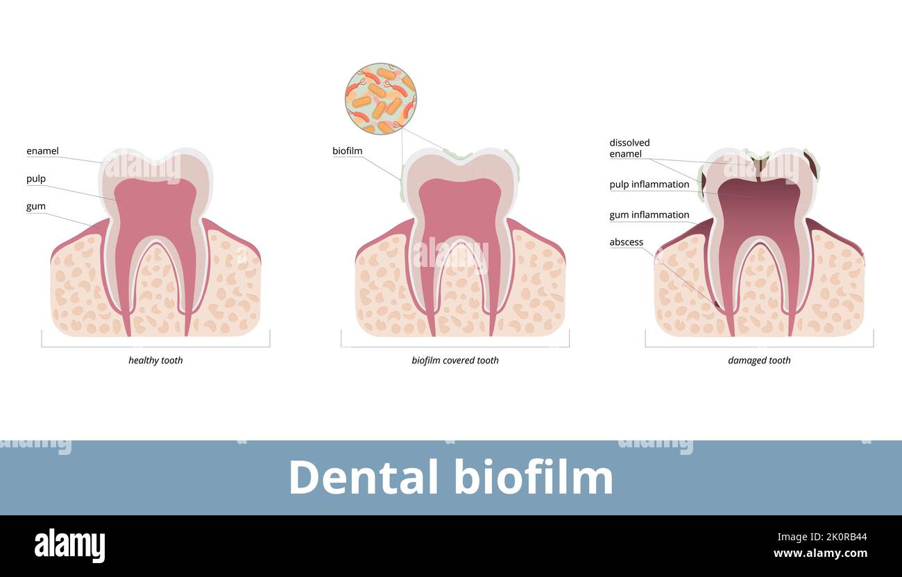 Biofilm bactérien Banque d'images vectorielles - Alamy