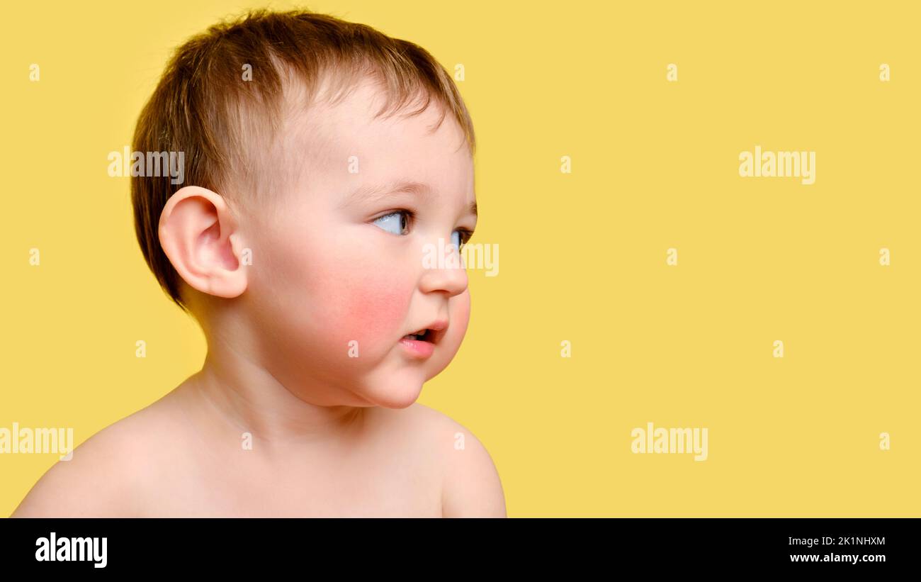 Bébé qui regarde avec des allergies sur son visage, fond jaune studio ...