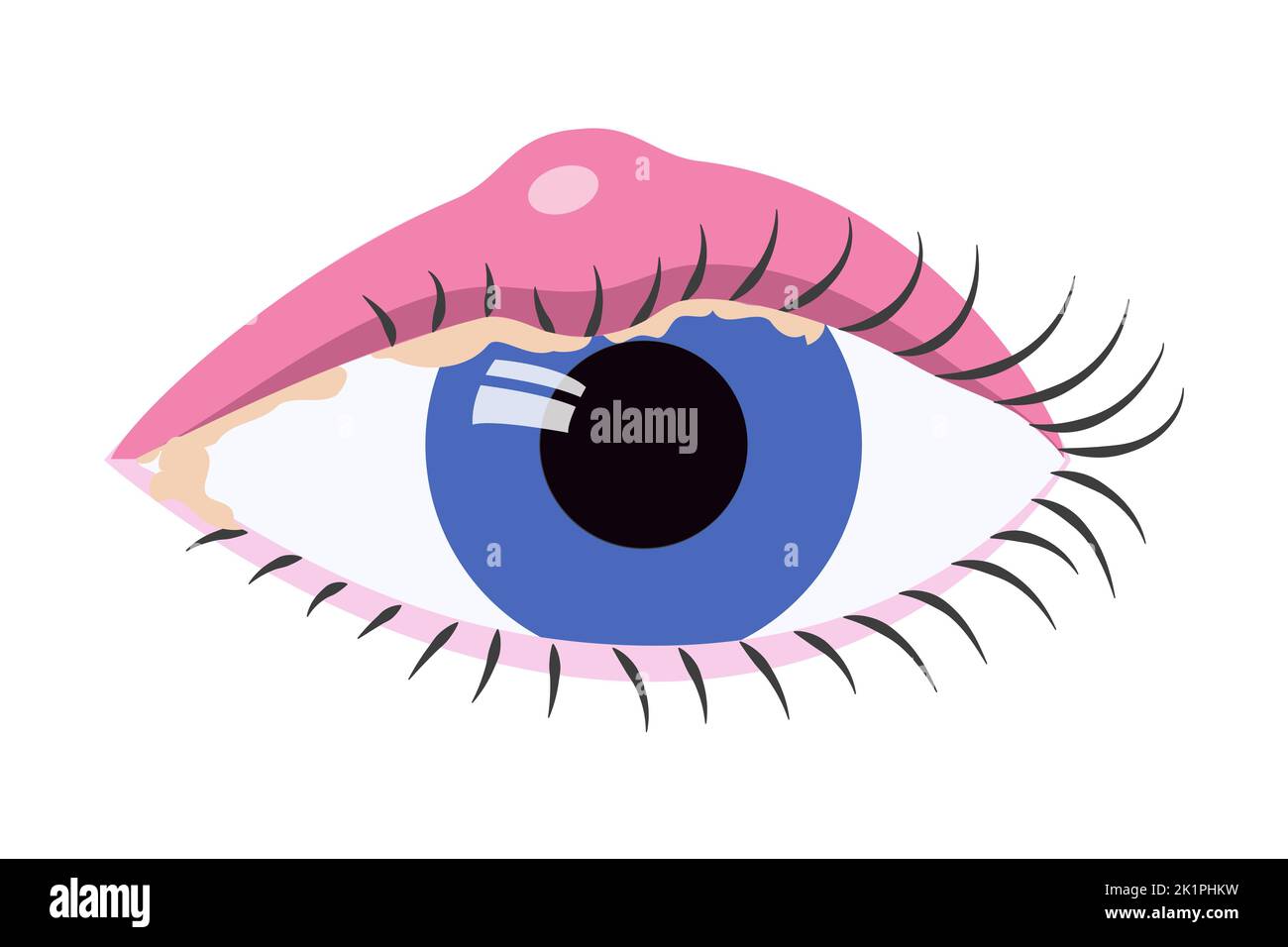 Eyelid swelling Banque d'images détourées - Alamy