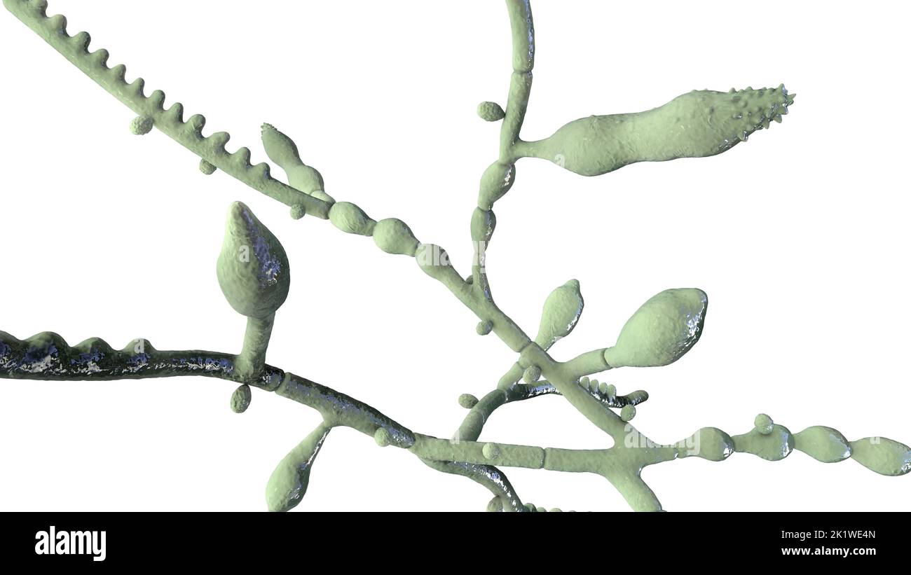 Fungus infection tinea manus Banque d'images détourées - Alamy