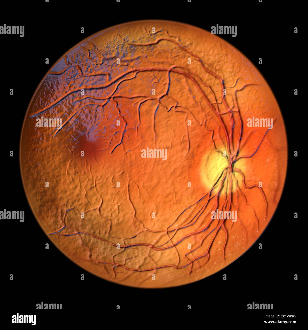 Retinal blood vessels Banque de photographies et d’images à haute ...