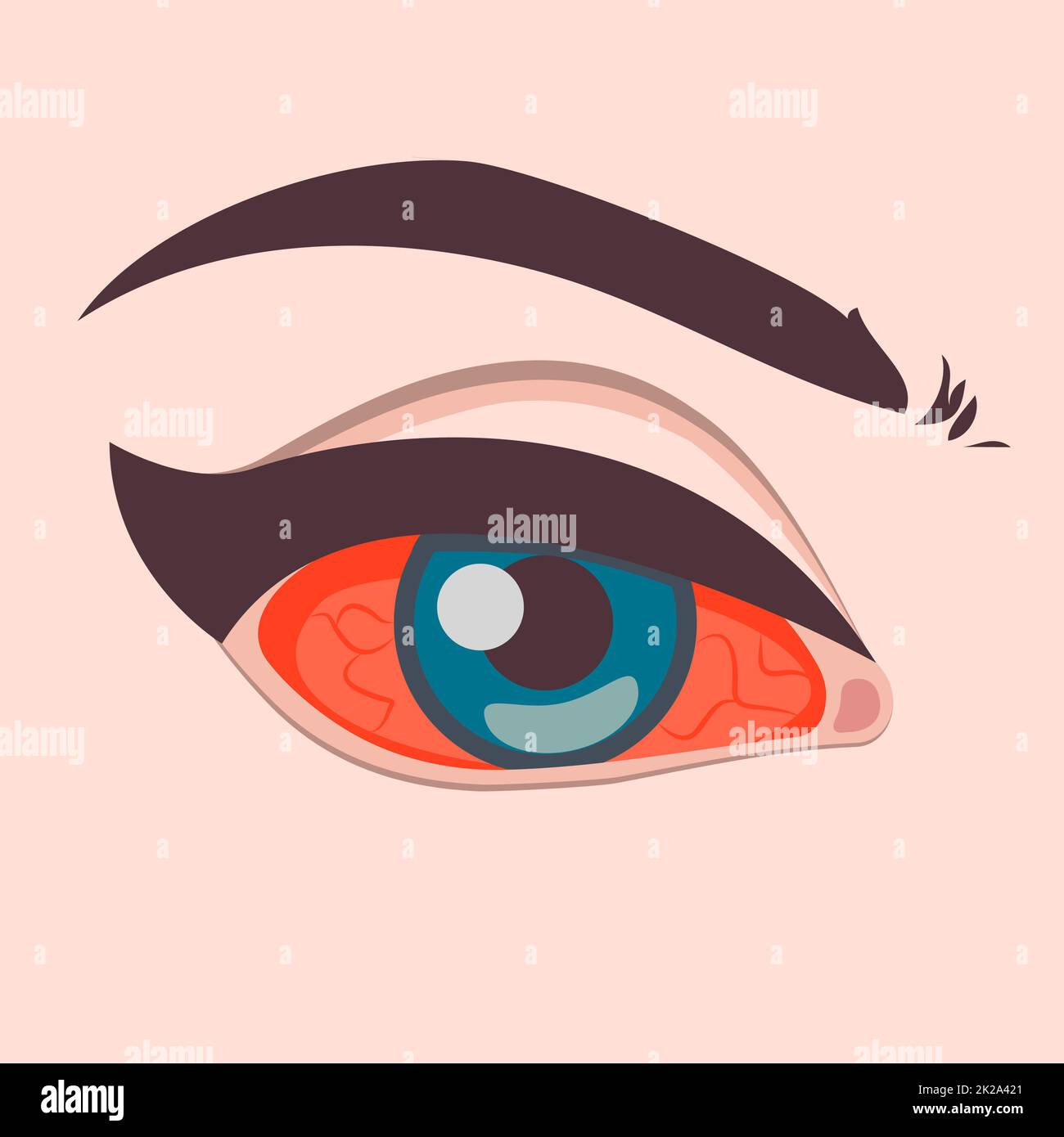 Trouble des yeux, des yeux douloureux, des yeux rouges enflammés, icône ...