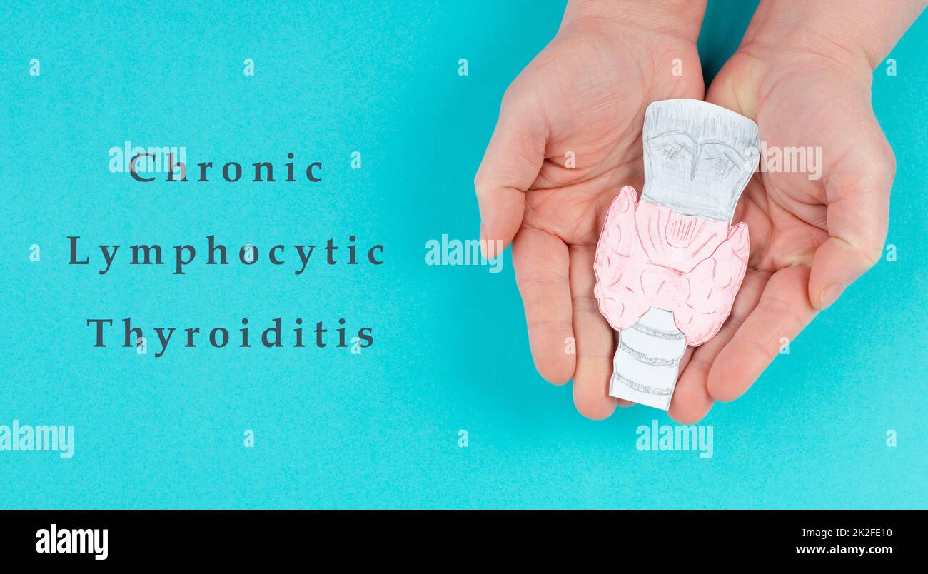 Thyroïdite d'Hashimoto, maladie lymphocytaire chronique, tenue d'un ...