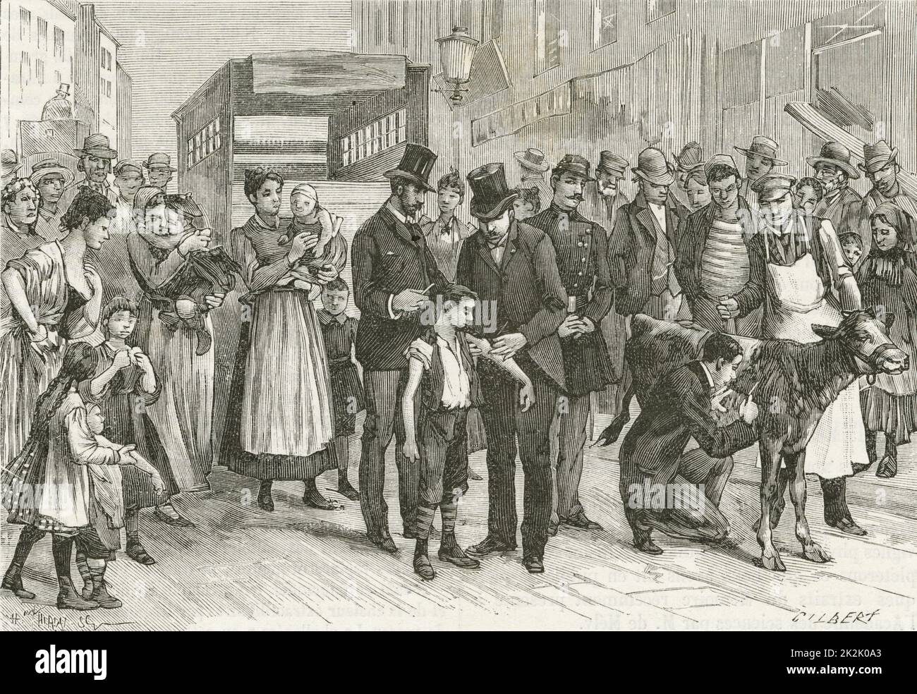 Smallpox 19th century Banque de photographies et d’images à haute ...