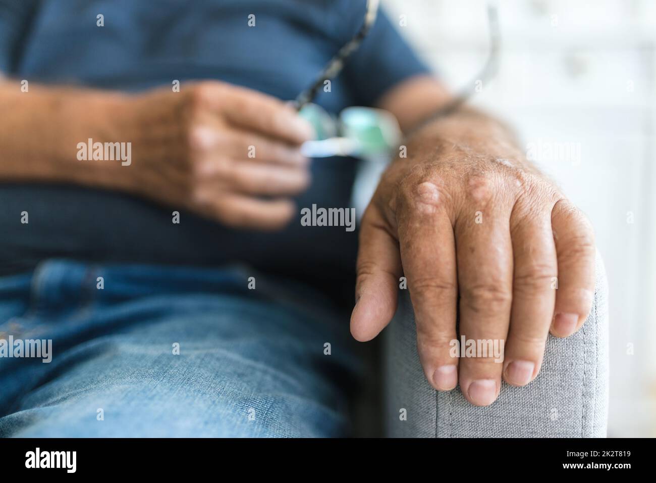 éruption cutanée sur les mains Banque de photographies et d’images à ...