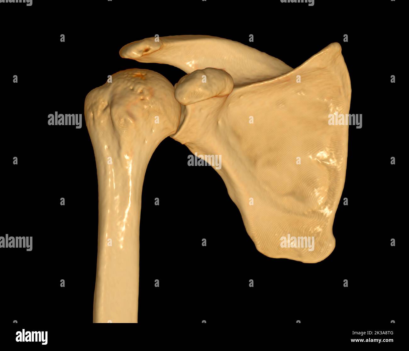 CT Shoulder 3D de la tomodensitométrie Volume Rendering examen du rendu ...