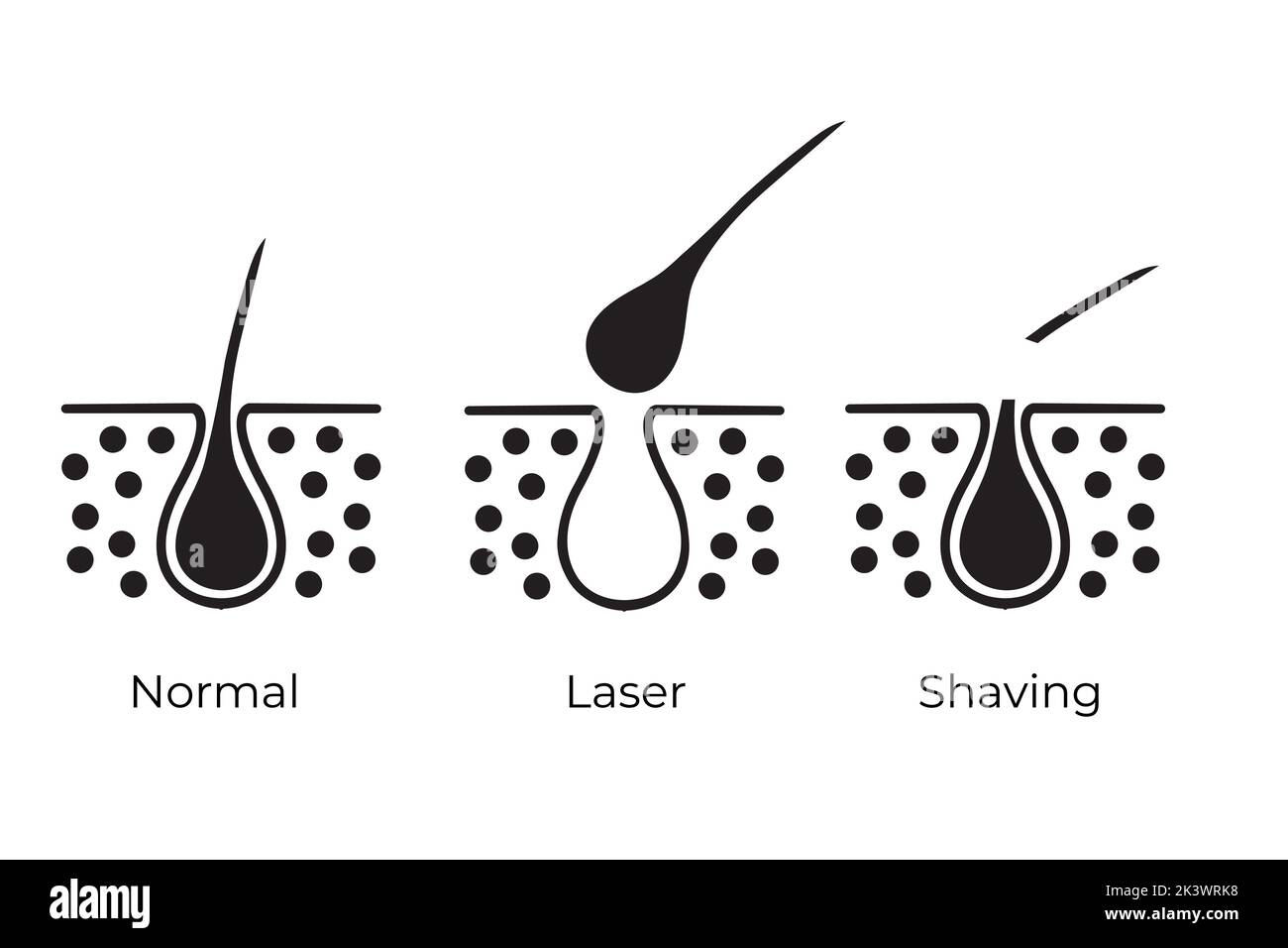 Racine de suppression Banque d'images vectorielles - Alamy