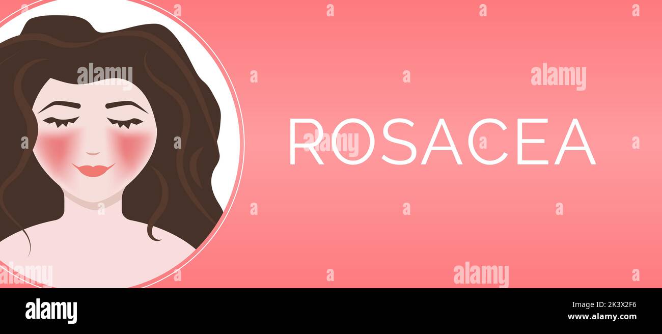 Femme maladie de la peau illustration Banque de photographies et d ...