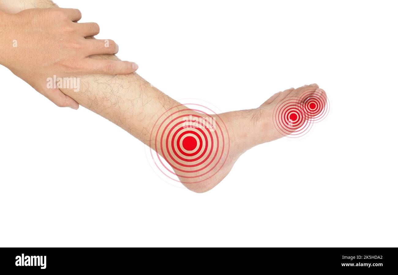 Inflammation multiple des articulations des pieds. Concept et idée de ...