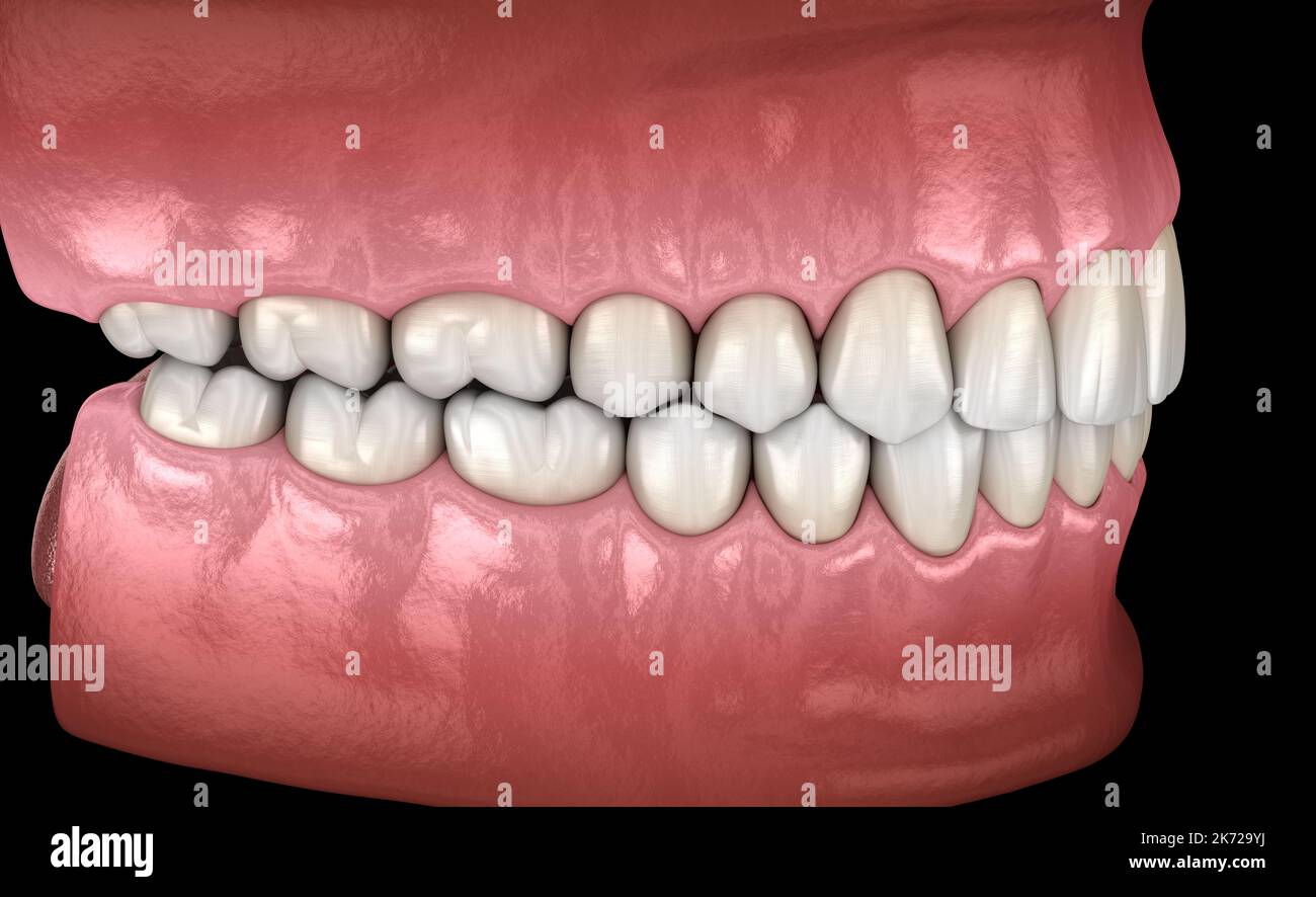 Morfología de la cavidad bucal Banque de photographies et d’images à ...