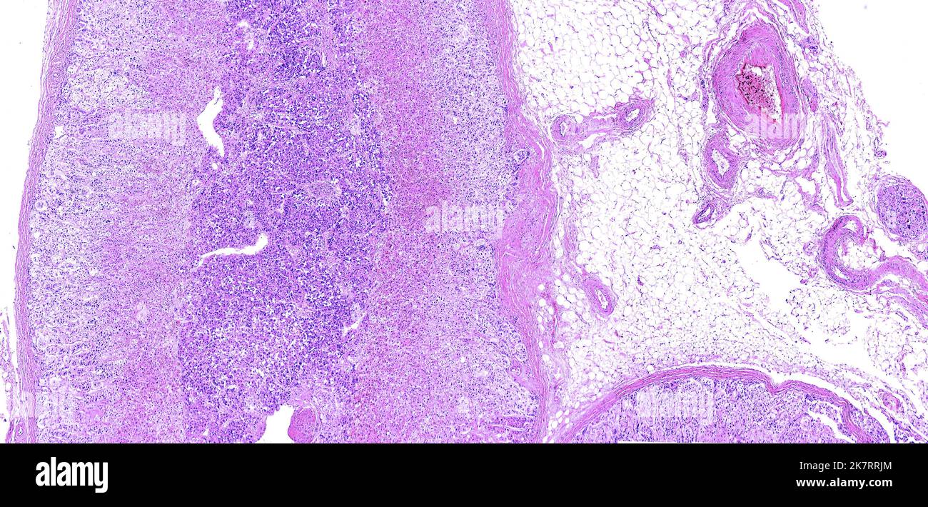 Micrographe léger d'une glande surrénale humaine montrant la capsule ...