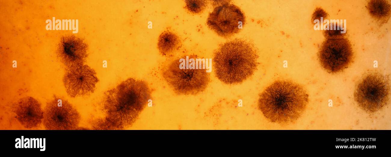 Microbes pathogènes Banque de photographies et d’images à haute ...