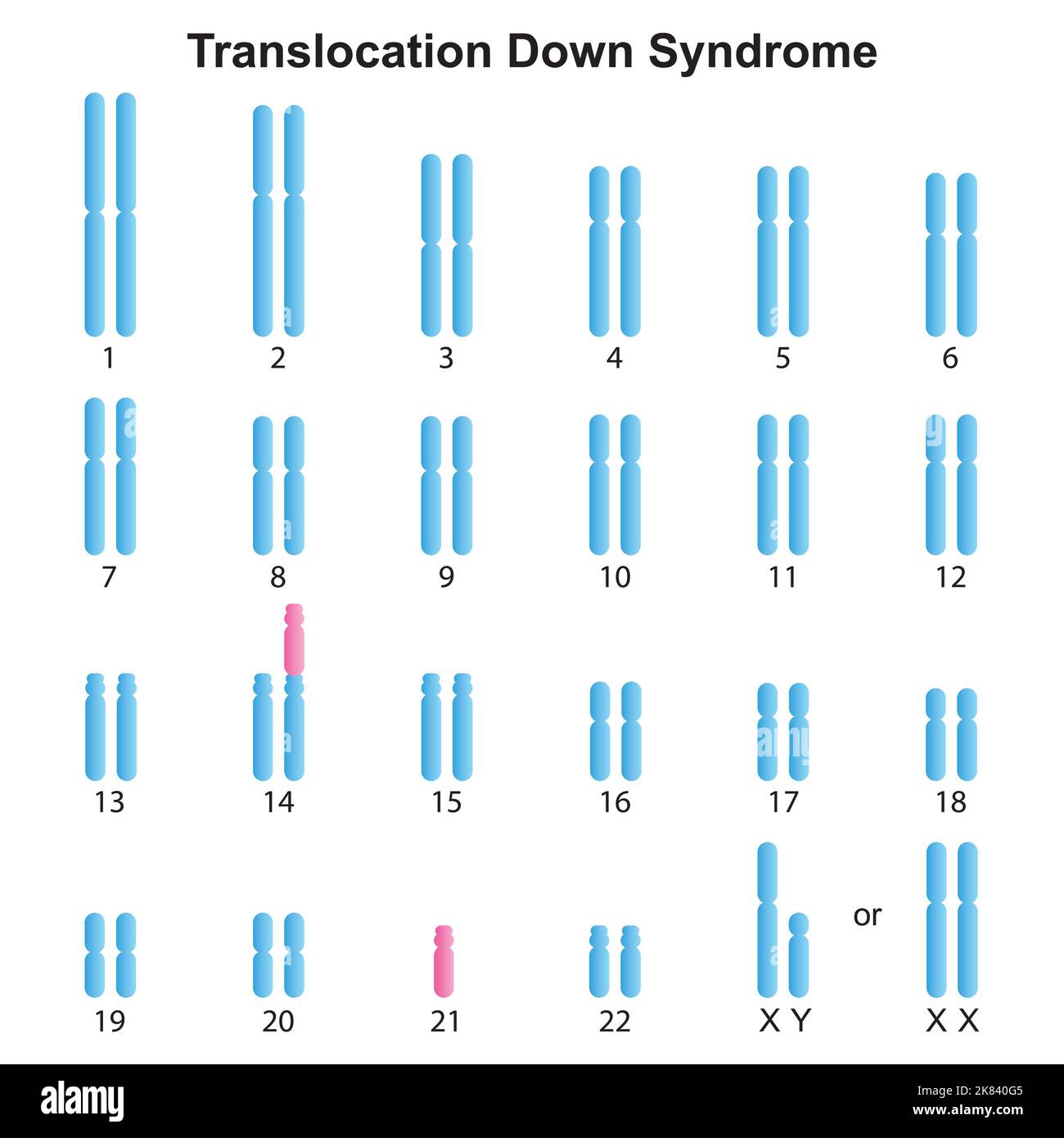 Conception scientifique de la translocation Robertsonian vers le bas ...