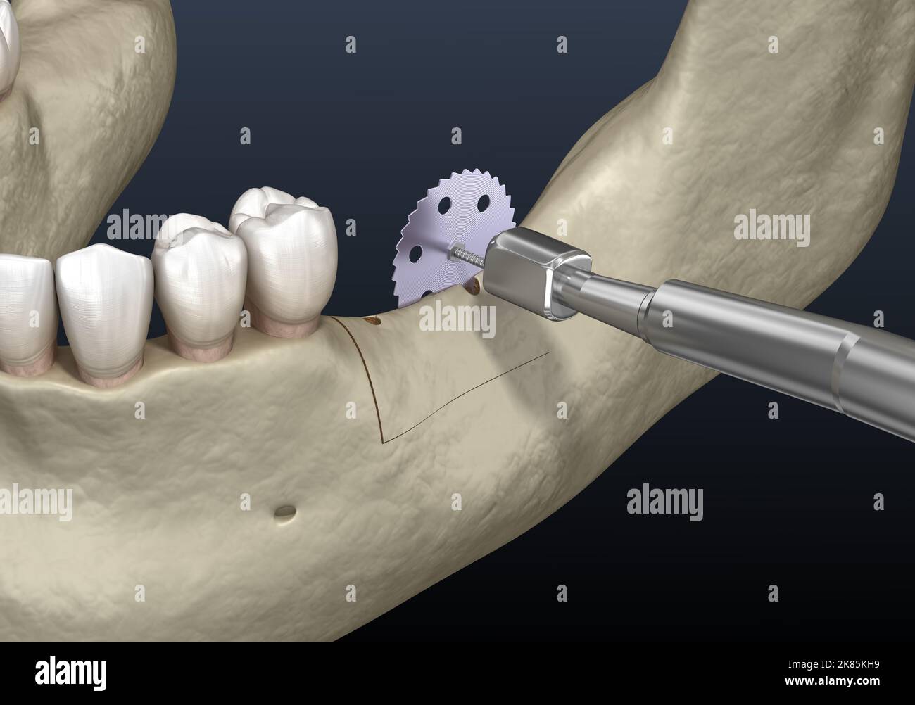 Crête alvéolaire Banque de photographies et d’images à haute résolution ...