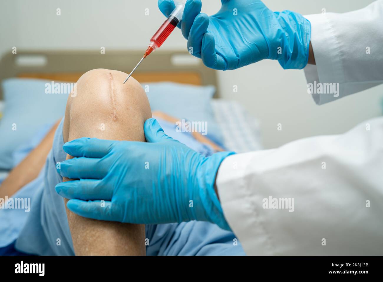 Ligament humain du genou Banque de photographies et d’images à haute ...