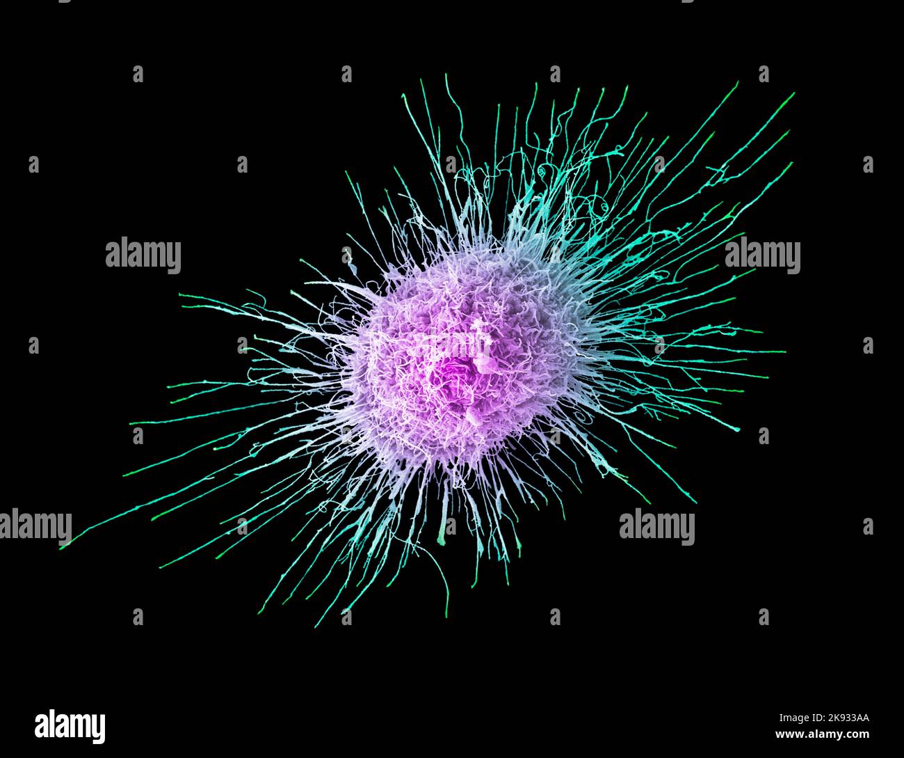 Cellule du cancer du col de l'utérus, SEM Photo Stock - Alamy
