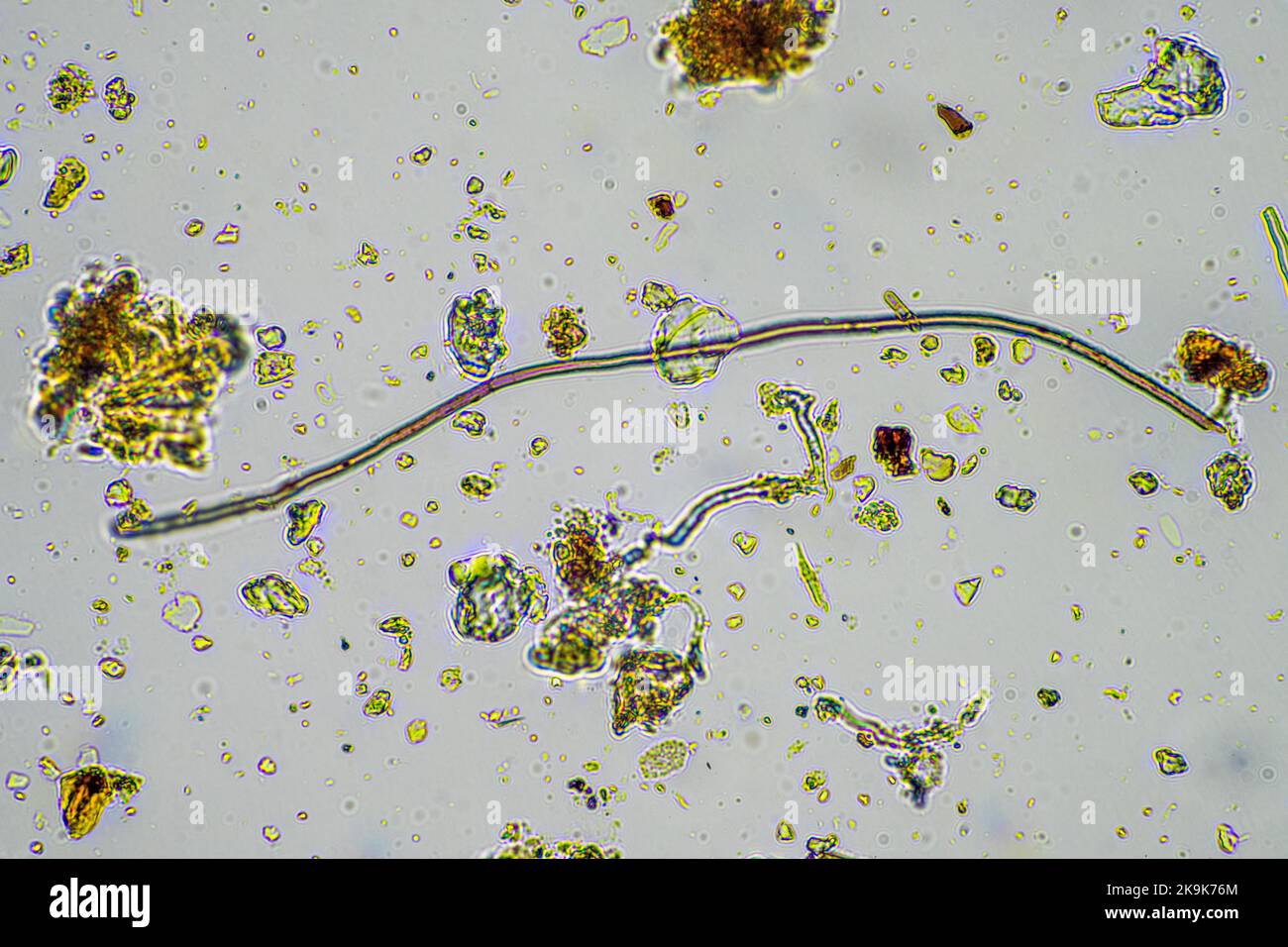 les micro-organismes du sol, avec des hyphes de champignons du sol qui ...