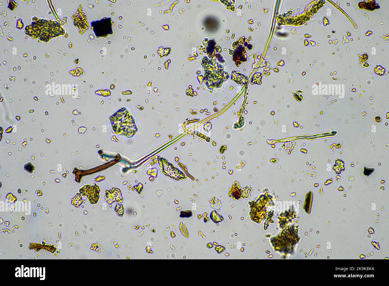 Les champignons et les hyphes sous microscope dans le sol et le compost ...