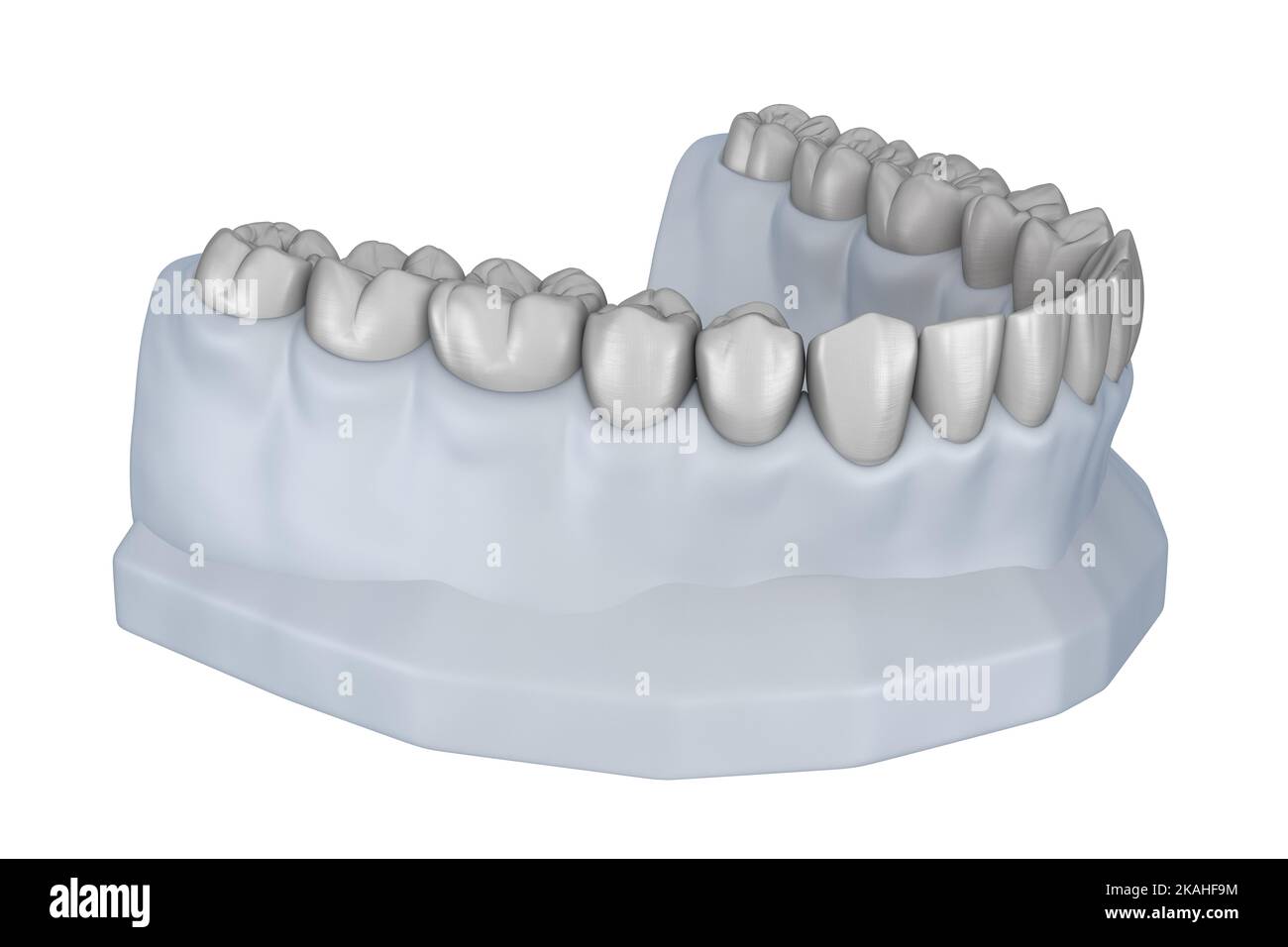 Modèle à dents cirées. Planification du traitement. Illustration de la dent 3D médicalement ...
