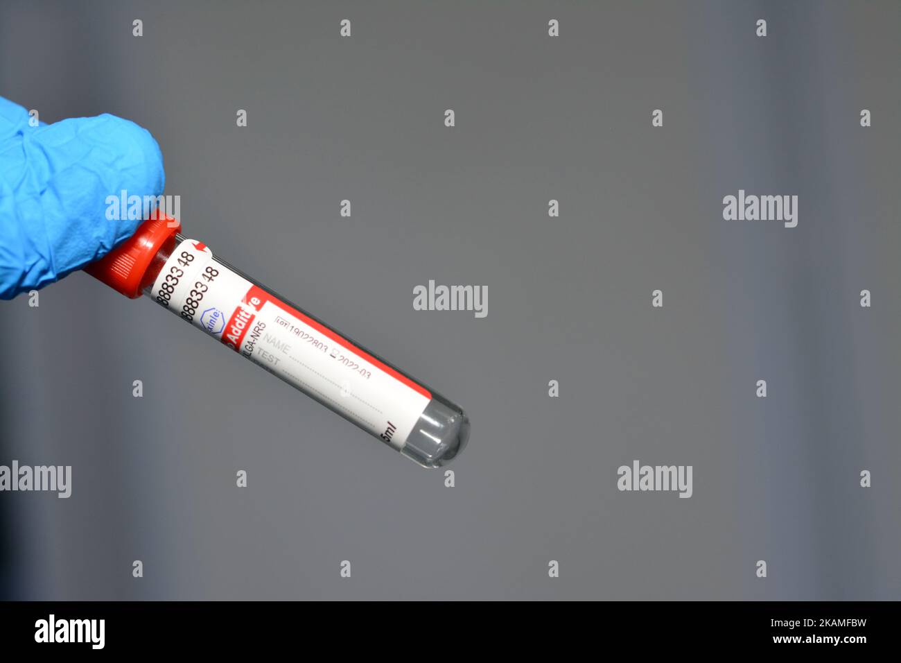 Le Caire, l'Egypte, 22 octobre 2022: Tube de prélèvement sanguin pour ...