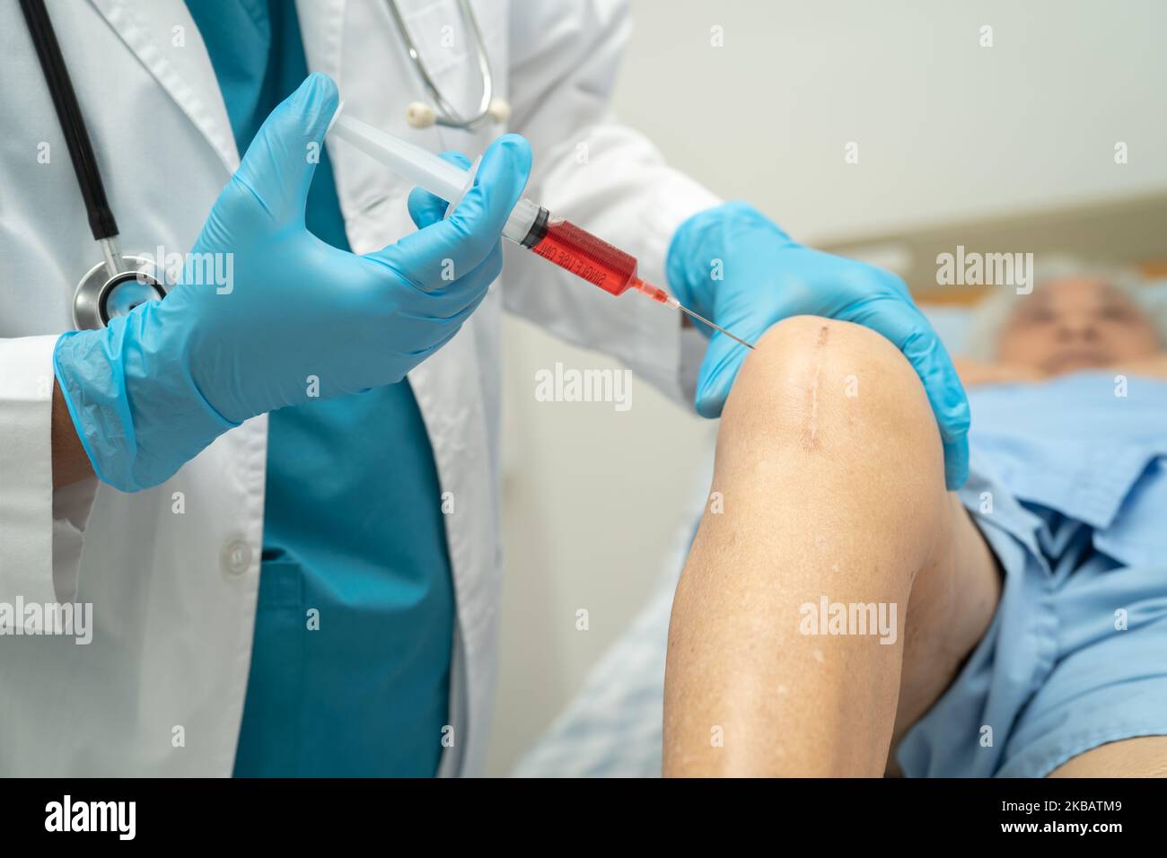 Un médecin asiatique injecte du plasma riche en plaquettes d'acide ...