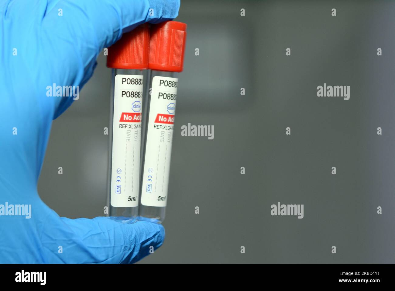 Le Caire, l'Egypte, 22 octobre 2022: Tube de prélèvement sanguin pour ...