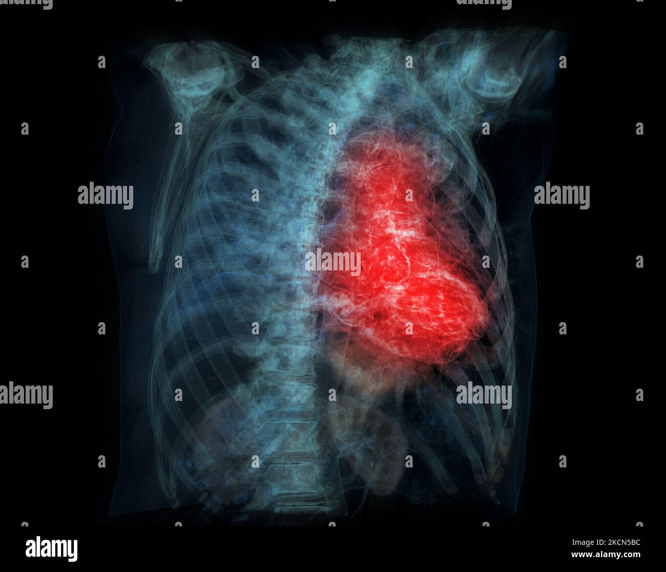 Les droits de l'attaque cardiaque de la douleur comme une anatomie ...