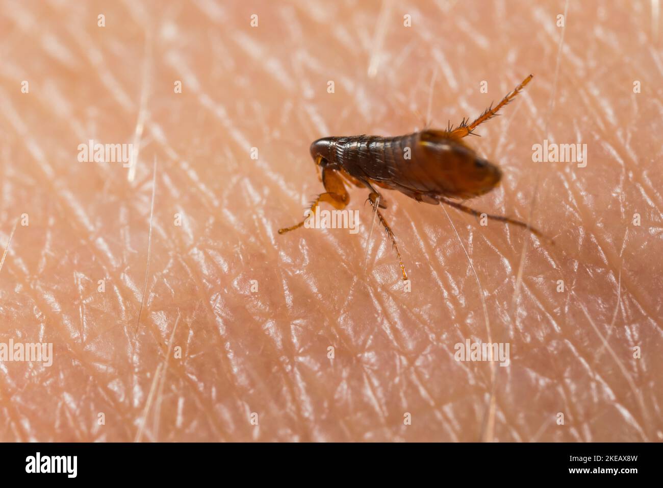 Puce humaine Banque de photographies et d’images à haute résolution - Alamy