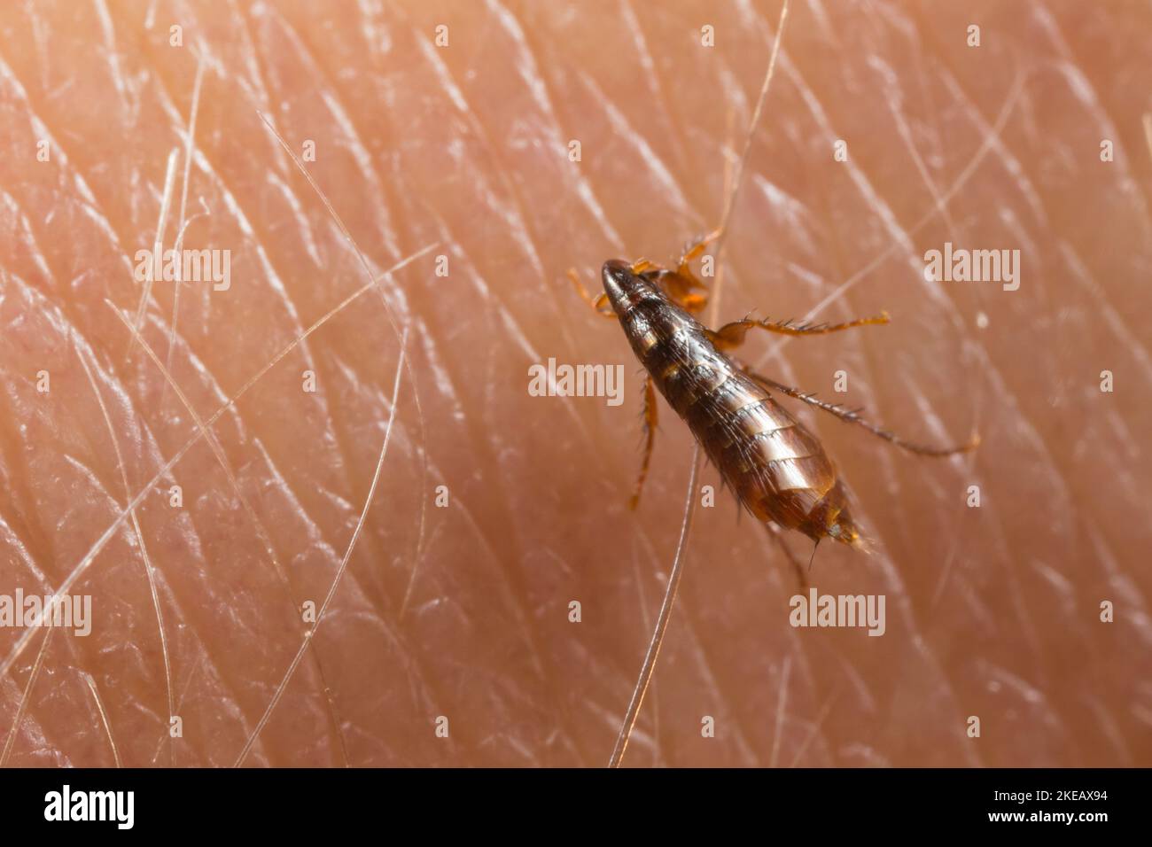 Puce humaine Banque de photographies et d’images à haute résolution - Alamy