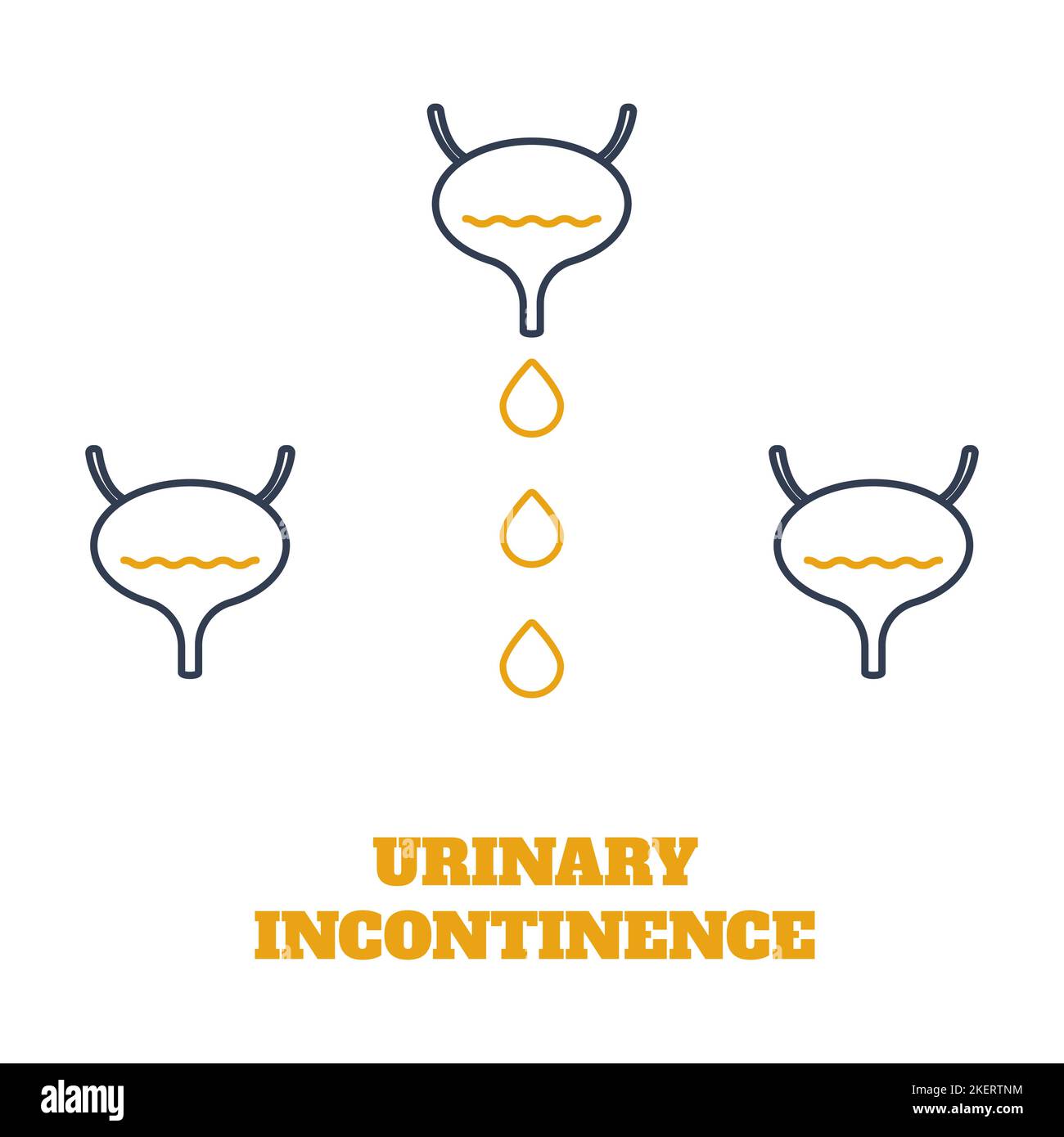 Incontinence urinaire maladie de la vessie schéma médical de ...