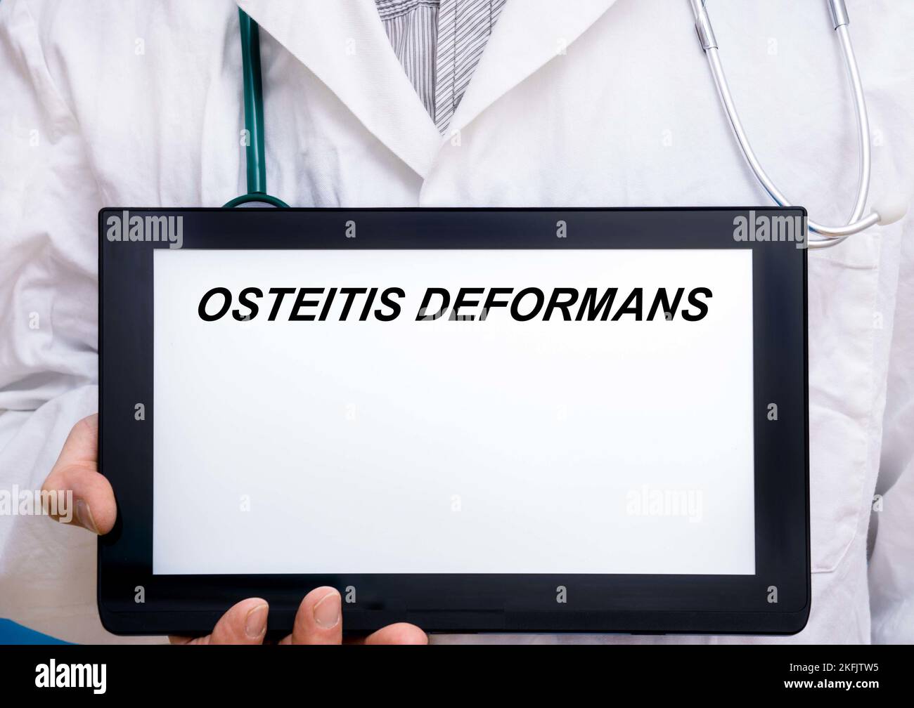 Maladie de l'ostéite déformante Banque de photographies et d’images à ...