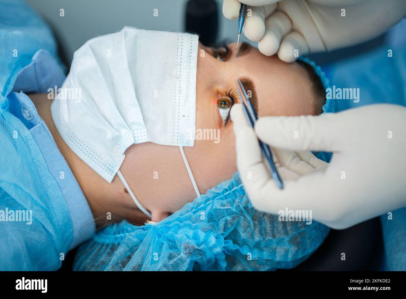correction de la vision laser. Traitement du glaucome. Technologies ...