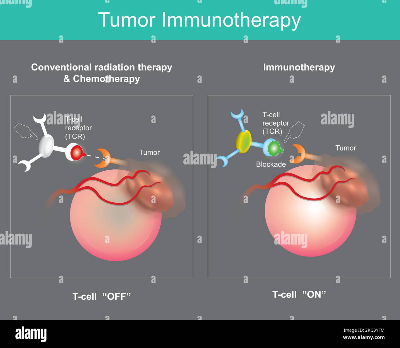 Immunothérapie tumorale. Traitement du cancer qui utilise le système ... Immunothérapie tumorale. Traitement du cancer qui utilise le système ...