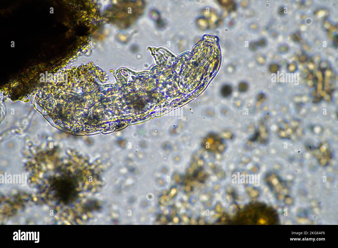 parasite humain. maladie intestinale d'infection intestinale. infection ...