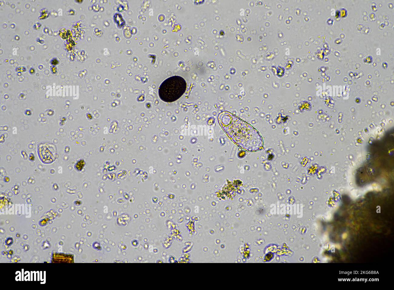 parasite humain. maladie intestinale d'infection intestinale. infection ...