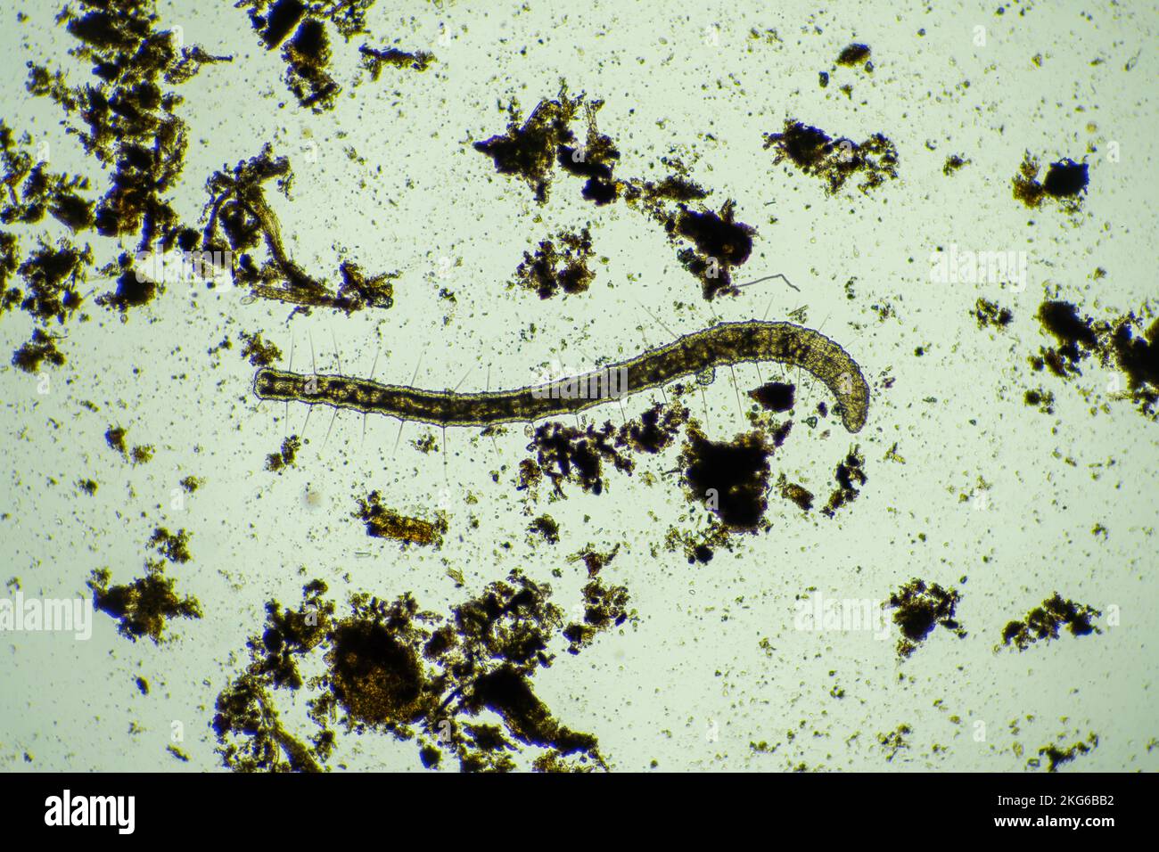 parasite humain. maladie intestinale d'infection intestinale. infection ...