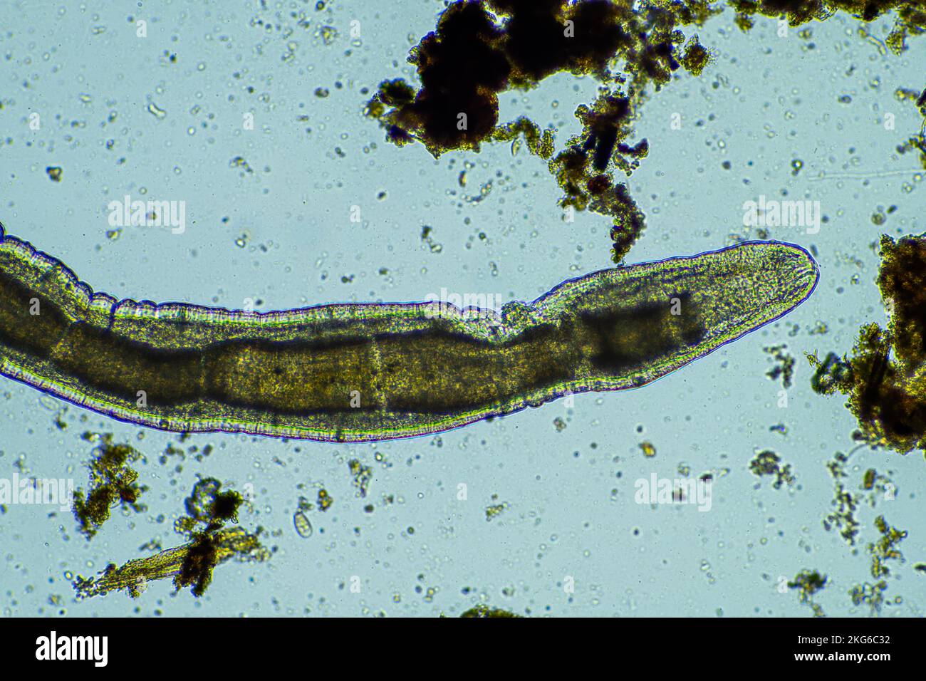 parasite humain. maladie intestinale d'infection intestinale. infection ...