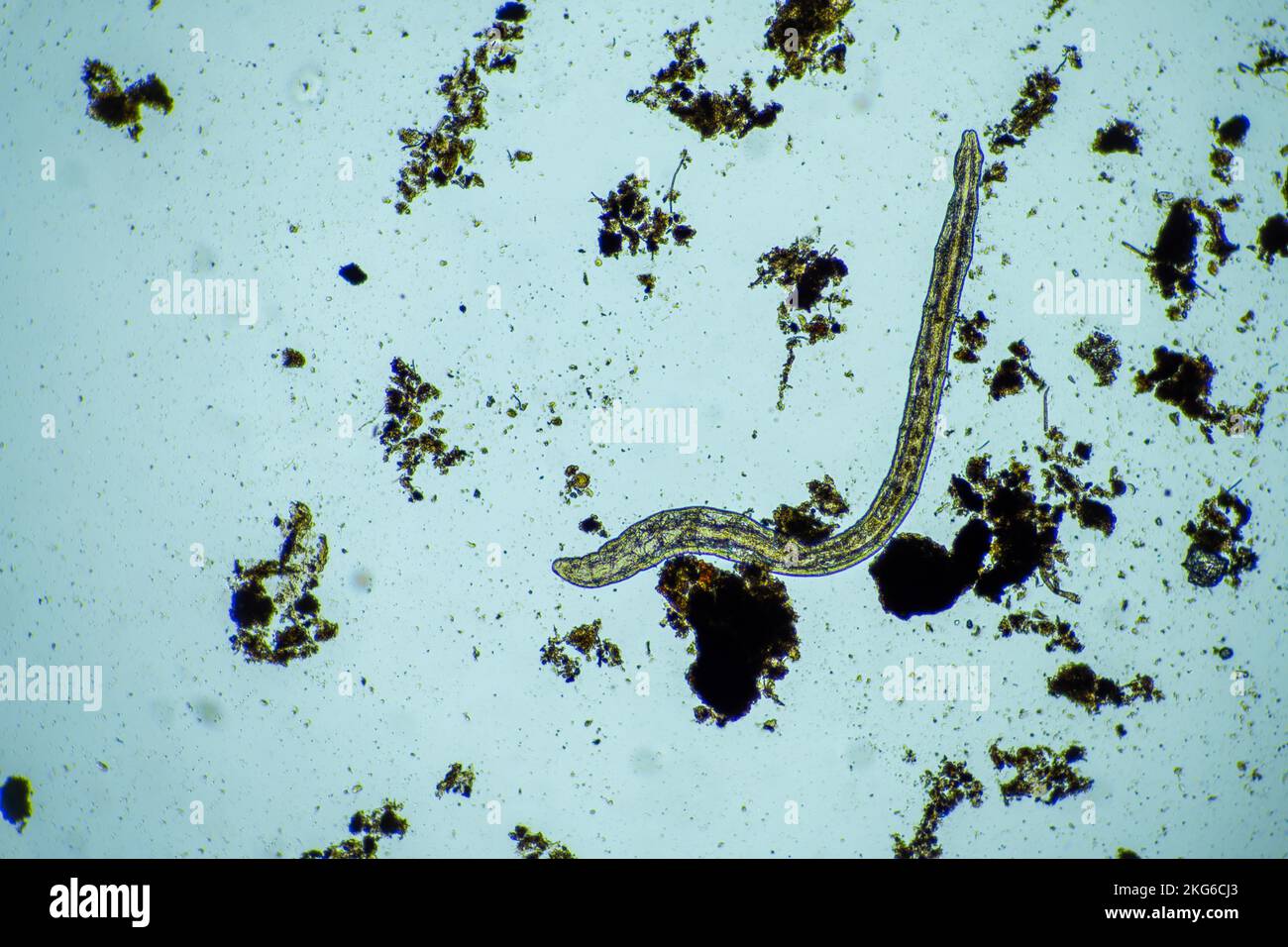 parasite humain. maladie intestinale d'infection intestinale. infection ...