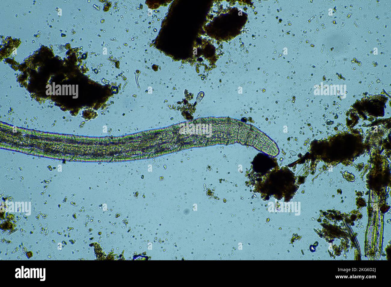 parasite humain. maladie intestinale d'infection intestinale. infection ...